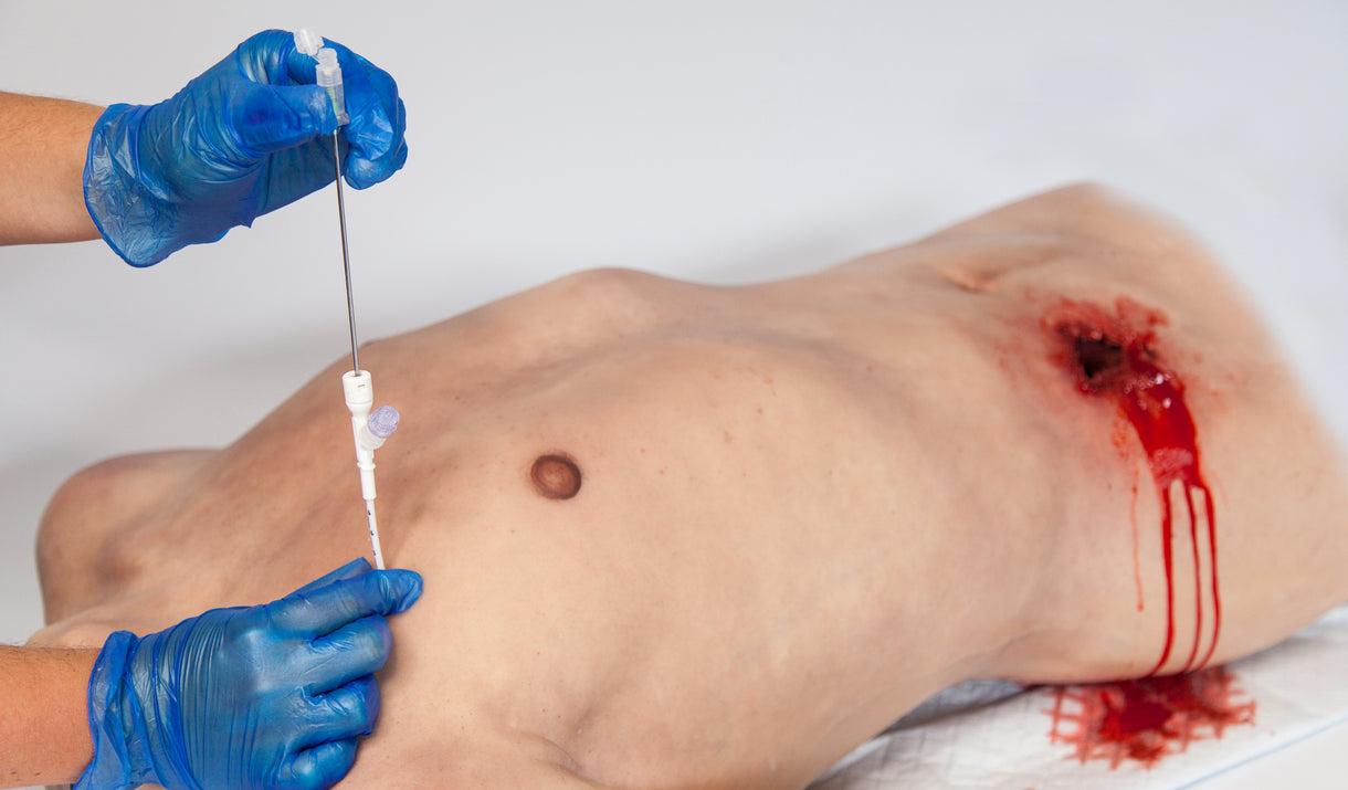 Safeguard Medical | Russell PneumoFix®